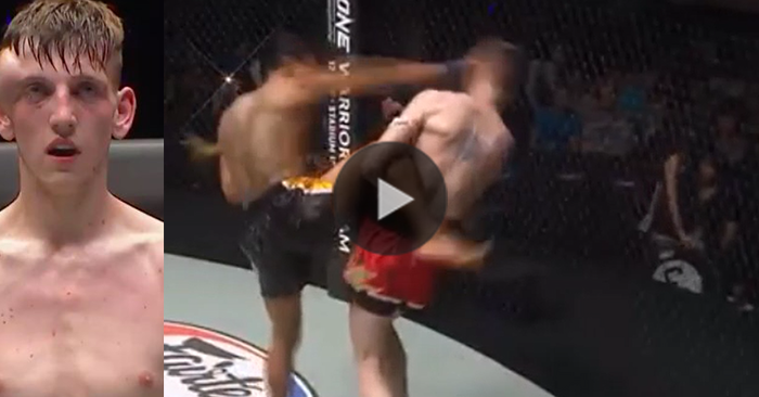Ouch! Fighter Suffers Worst Facial Injury Of The Year Contender - Watch ...